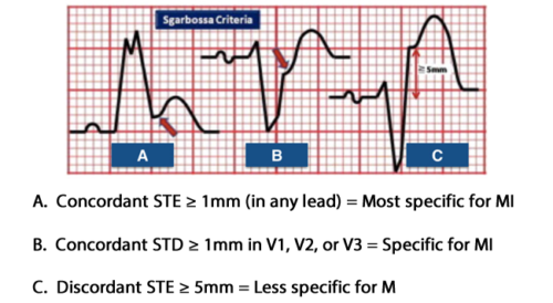 ECG Weekly – Learn ECGs One Week at a Time