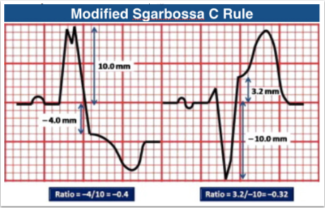 ECG Weekly – Learn ECGs One Week at a Time