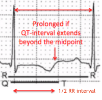 ECG Weekly – Learn ECGs One Week at a Time