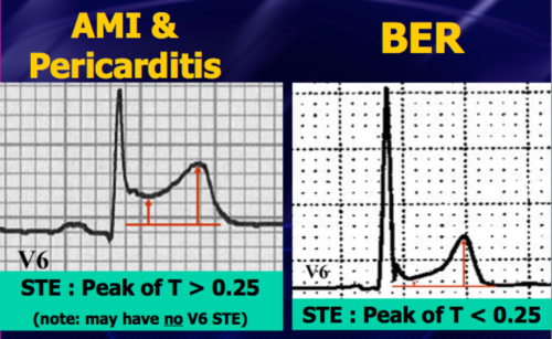 ECG Weekly – Learn ECGs One Week at a Time