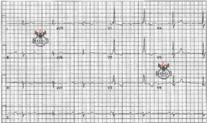 ECG Weekly – Learn ECGs One Week at a Time