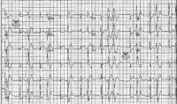 ECG Weekly – Learn ECGs One Week at a Time