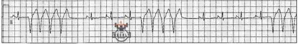 ECG Weekly – Learn ECGs One Week at a Time