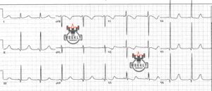 ECG Weekly – Learn ECGs One Week at a Time