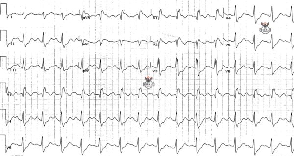 Login – ECG Weekly