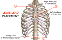 ECG Weekly – Learn ECGs One Week at a Time