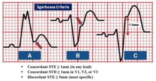ECG Weekly – Learn ECGs One Week at a Time