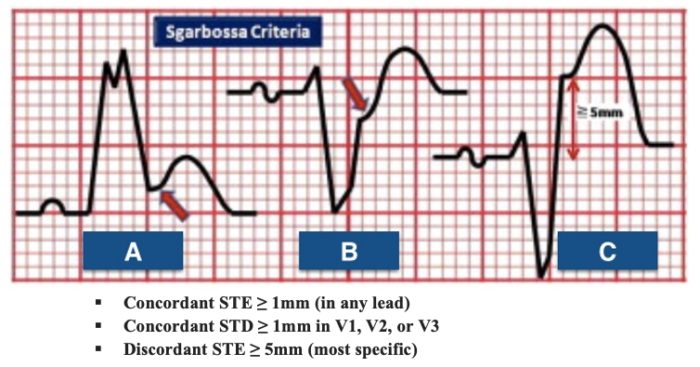 ECG Weekly – Learn ECGs One Week at a Time