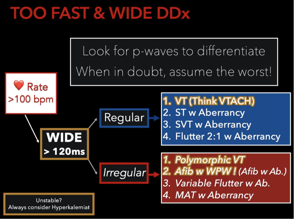 Wide & Regular Tachydysrhythmia DDx – ECG Weekly
