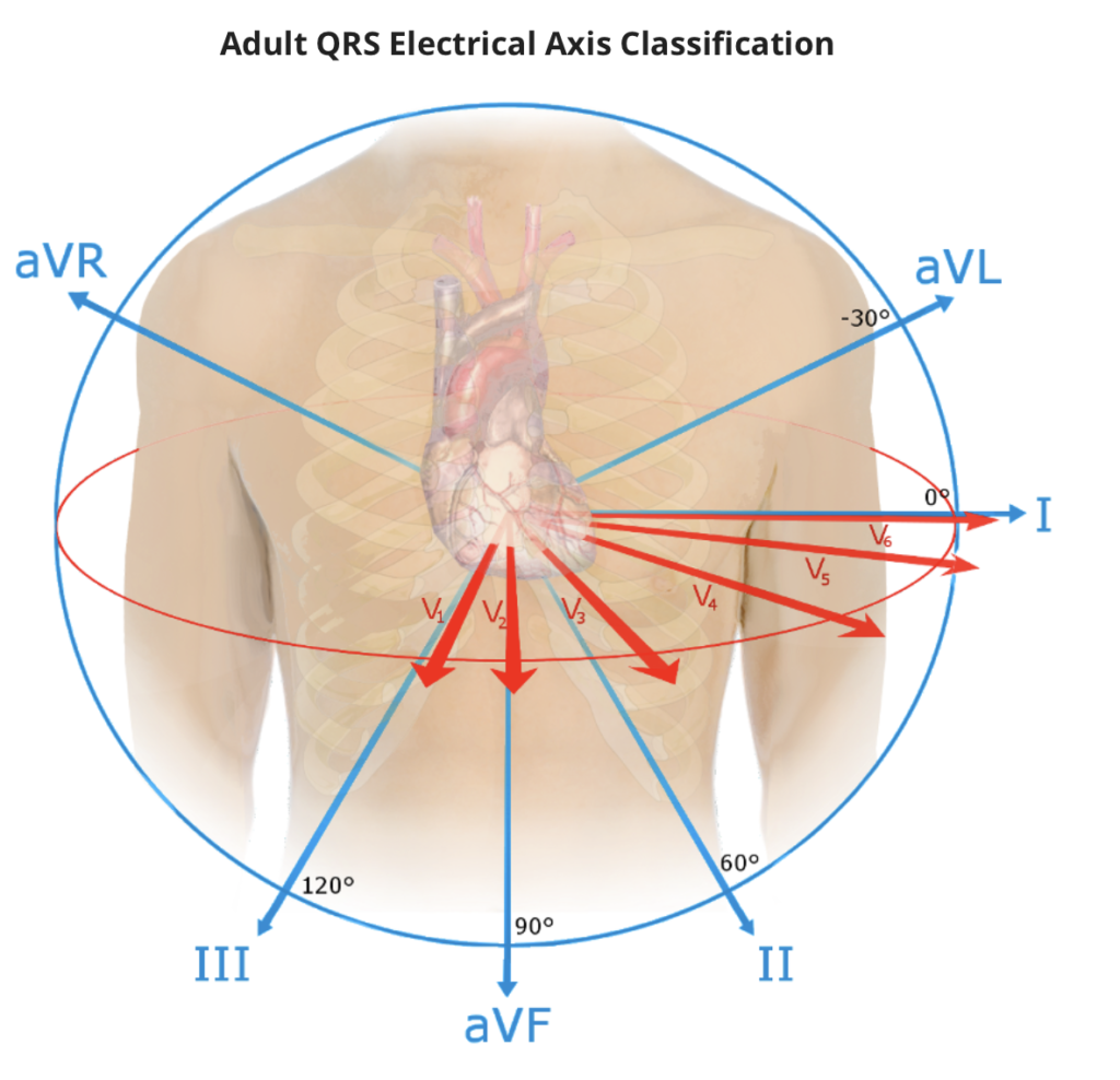 Axis Basics ECG Weekly Axis Basics ECG Weekly