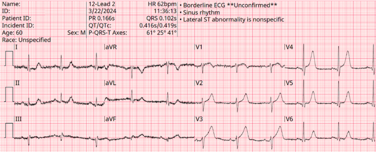 2024 EMS Cases Part IV – ECG Weekly