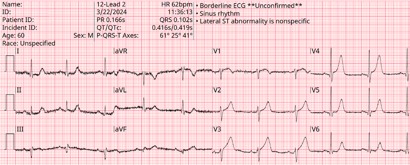 2024 EMS Cases Part IV – ECG Weekly