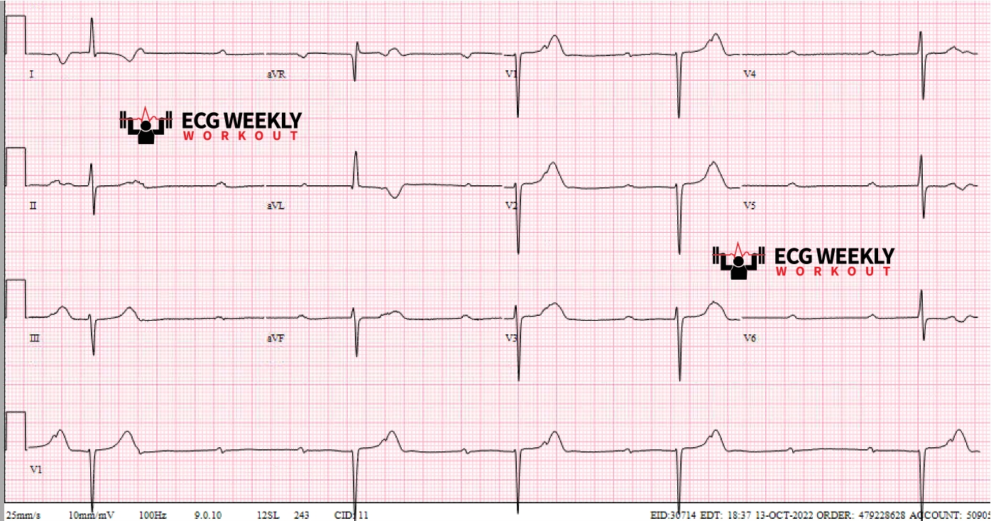 Weekly Case – ECG Weekly
