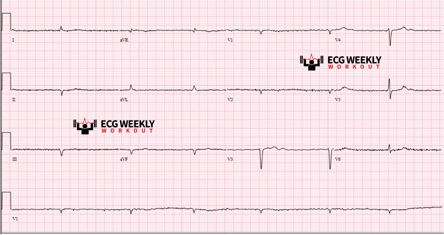 Weekly Case – ECG Weekly
