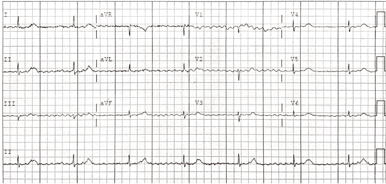 Weekly Case – ECG Weekly