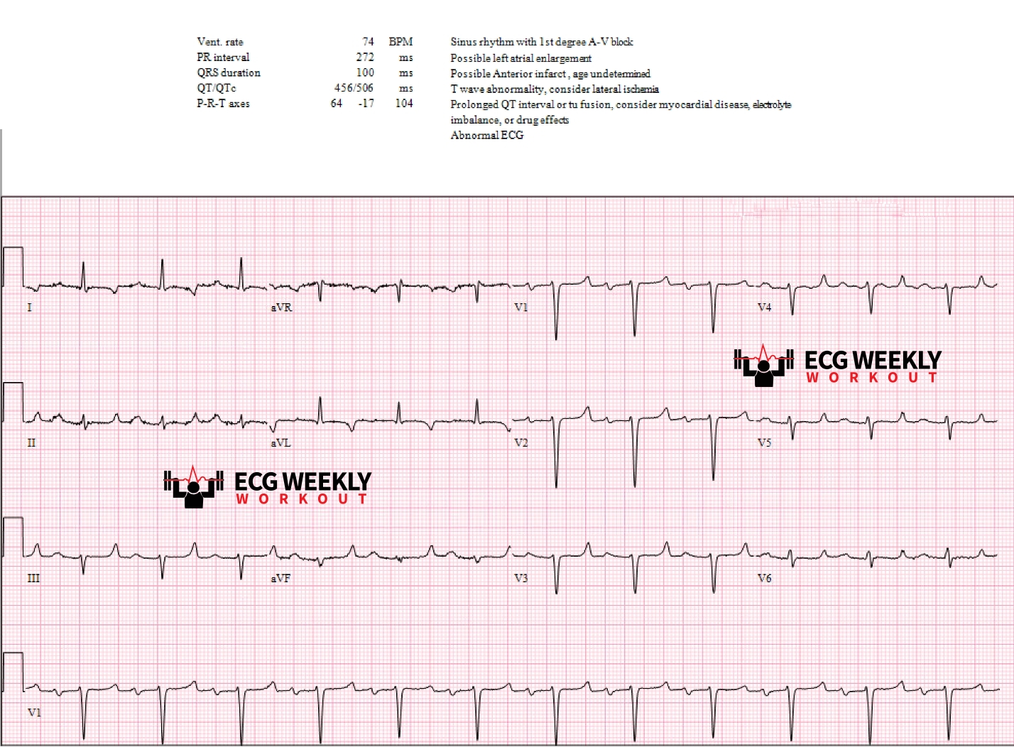 Case-445 – ECG Weekly