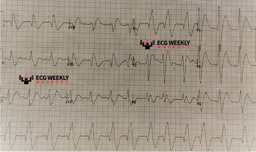 Weekly Case – ECG Weekly