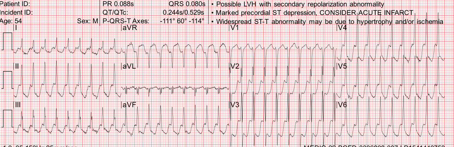 Several challenging EMS cases to help you make the diagnosis and save ...