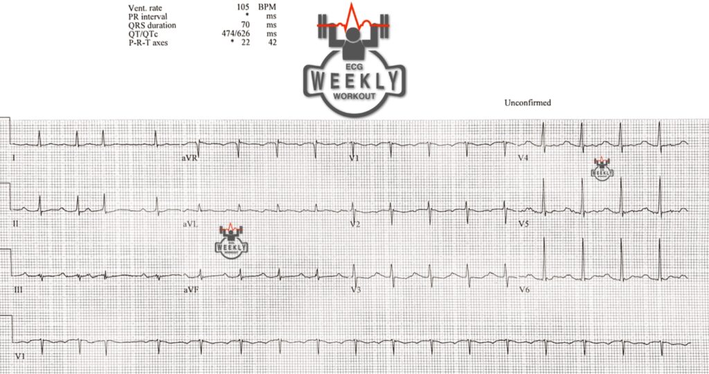 Differential Diagnoses: interval abnormalities and the importance of ...