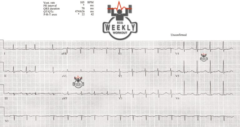 Differential Diagnoses: interval abnormalities and the importance of ...