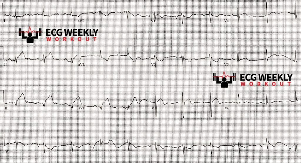 Potpourri of cases: critical electrolyte abnormalities, clumped or ...
