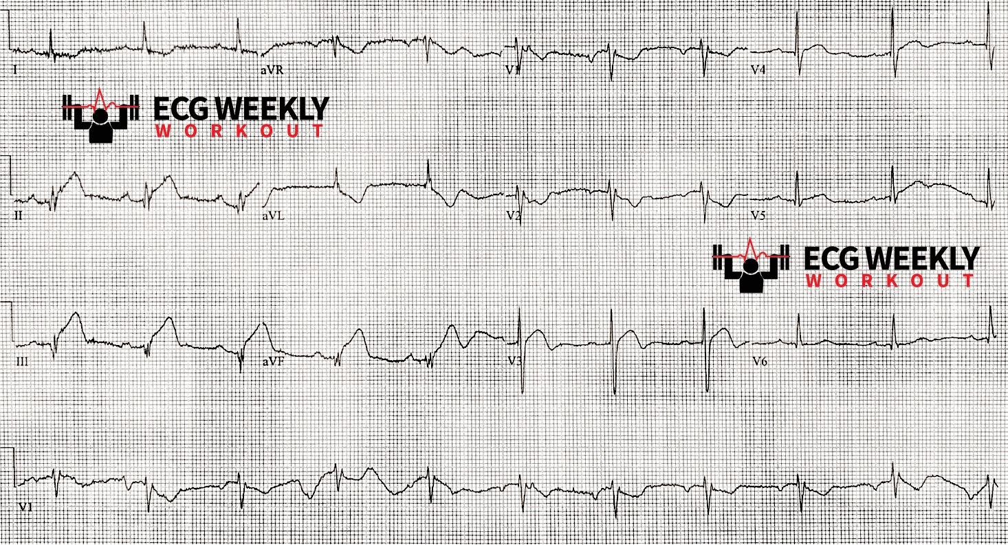 Potpourri of cases: critical electrolyte abnormalities, clumped or ...