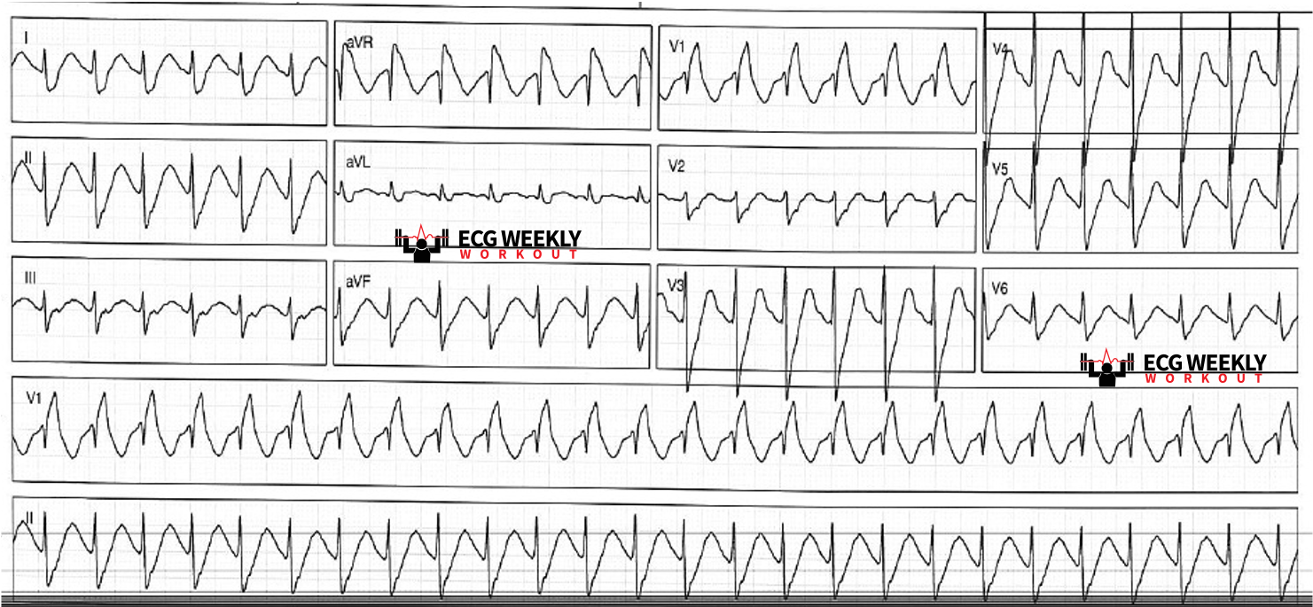 Differential Diagnoses: important considerations in patients with new ...