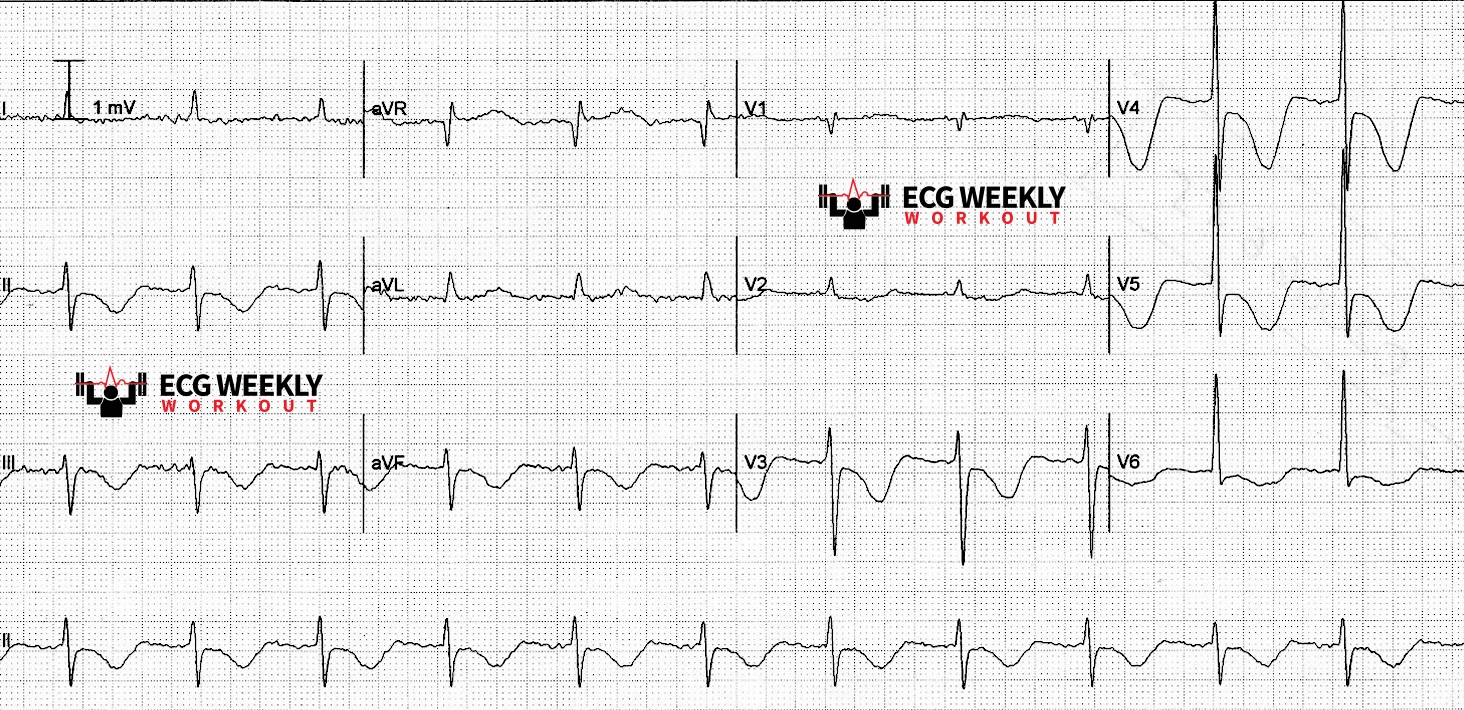 STAT ECG Diagnoses: the value of expert ECG interpretation when dealing with patients with ...