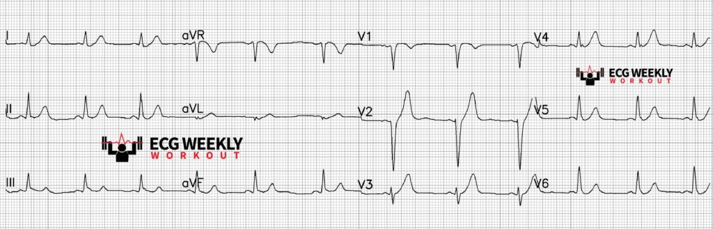 The value of obtaining a thorough history of presenting illness in patients with chest pain ...