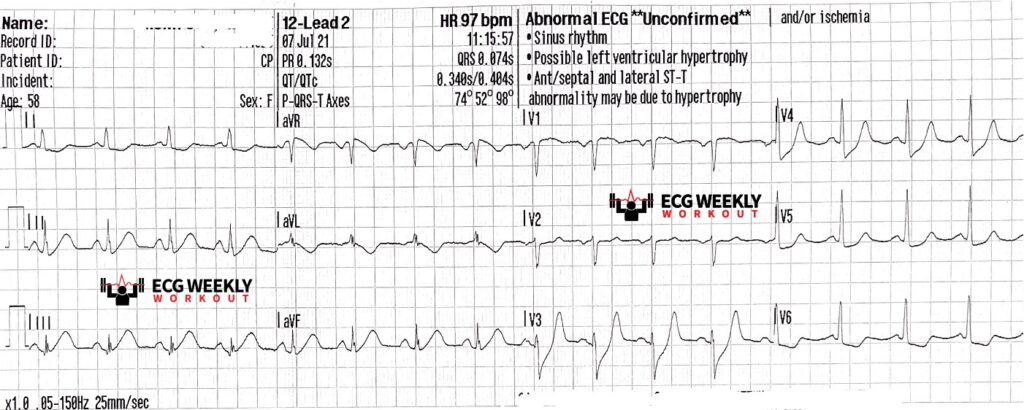 Case 433 – ECG Weekly