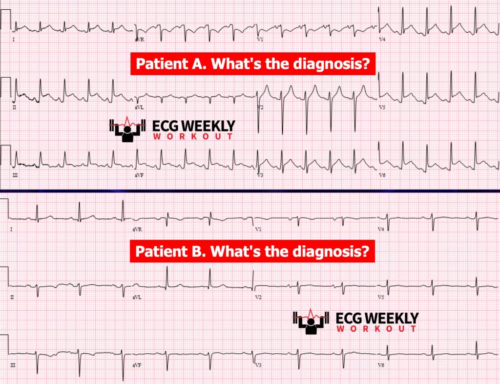 Case 436 – ECG Weekly