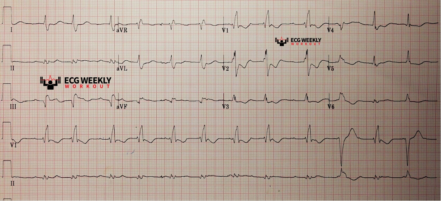 Rhythm Interpretation: Sutton’s rule for the best lead to evaluate ...