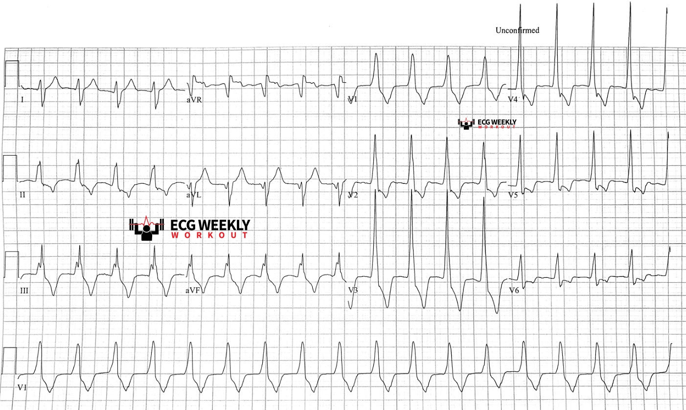 Case 450 – ECG Weekly