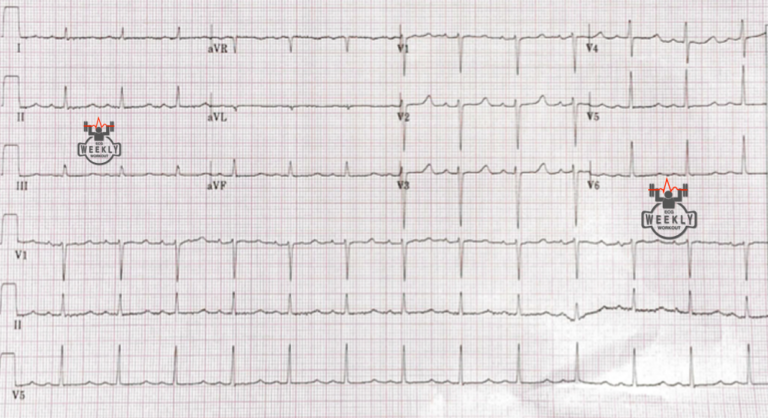 Differential Diagnoses: a 5 step approach to comprehensive ECG ...
