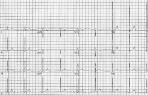 Case 287 – ECG Weekly