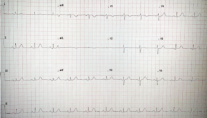 Case 299 – ECG Weekly