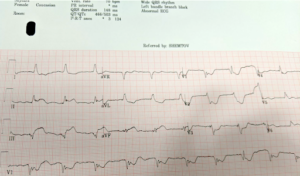 Case 300 – ECG Weekly