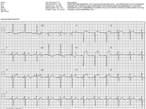 Case 318 – ECG Weekly