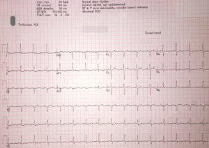 Case 329 – ECG Weekly