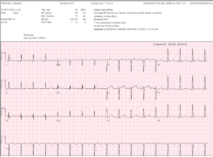 Case 348 1 – ECG Weekly