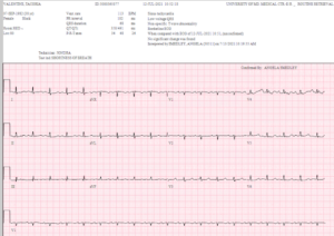 Case 348 2 – ECG Weekly