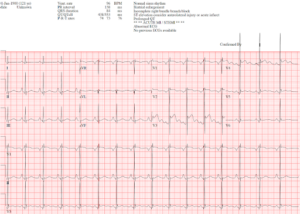Case 384 – ECG Weekly