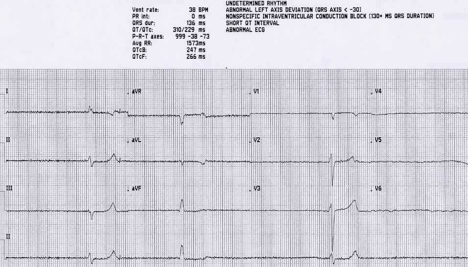 Case 470 – ECG Weekly