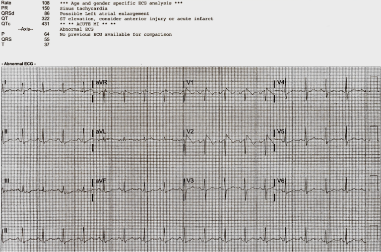 Case 471 – ECG Weekly