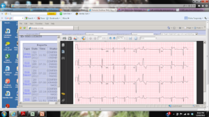 Case 166 – ECG Weekly