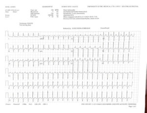 Case 185 – ECG Weekly