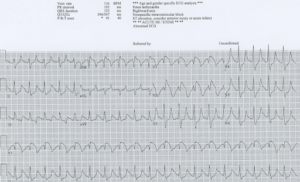 Case 275 – ECG Weekly