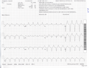 Case 278 – ECG Weekly