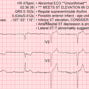 South African Flag Sign – ECG Weekly
