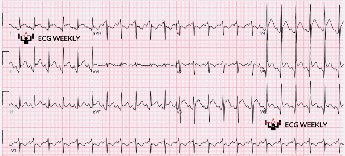 2024 EM Boards ECG Review Part I – ECG Weekly